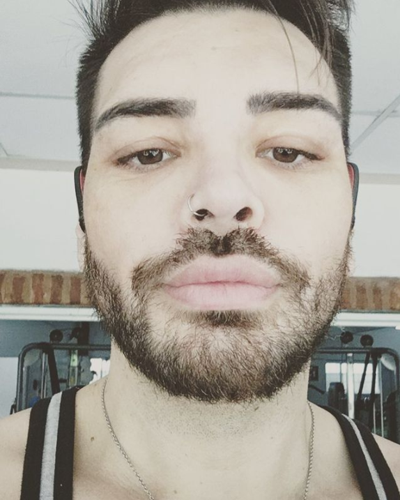 El ex Cuestión de peso que bajó 90 kilos y se operó 28 veces para ...