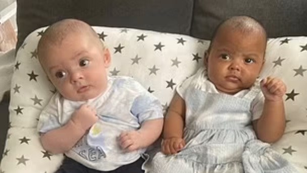 Dio a luz gemelos con distinto color de piel
