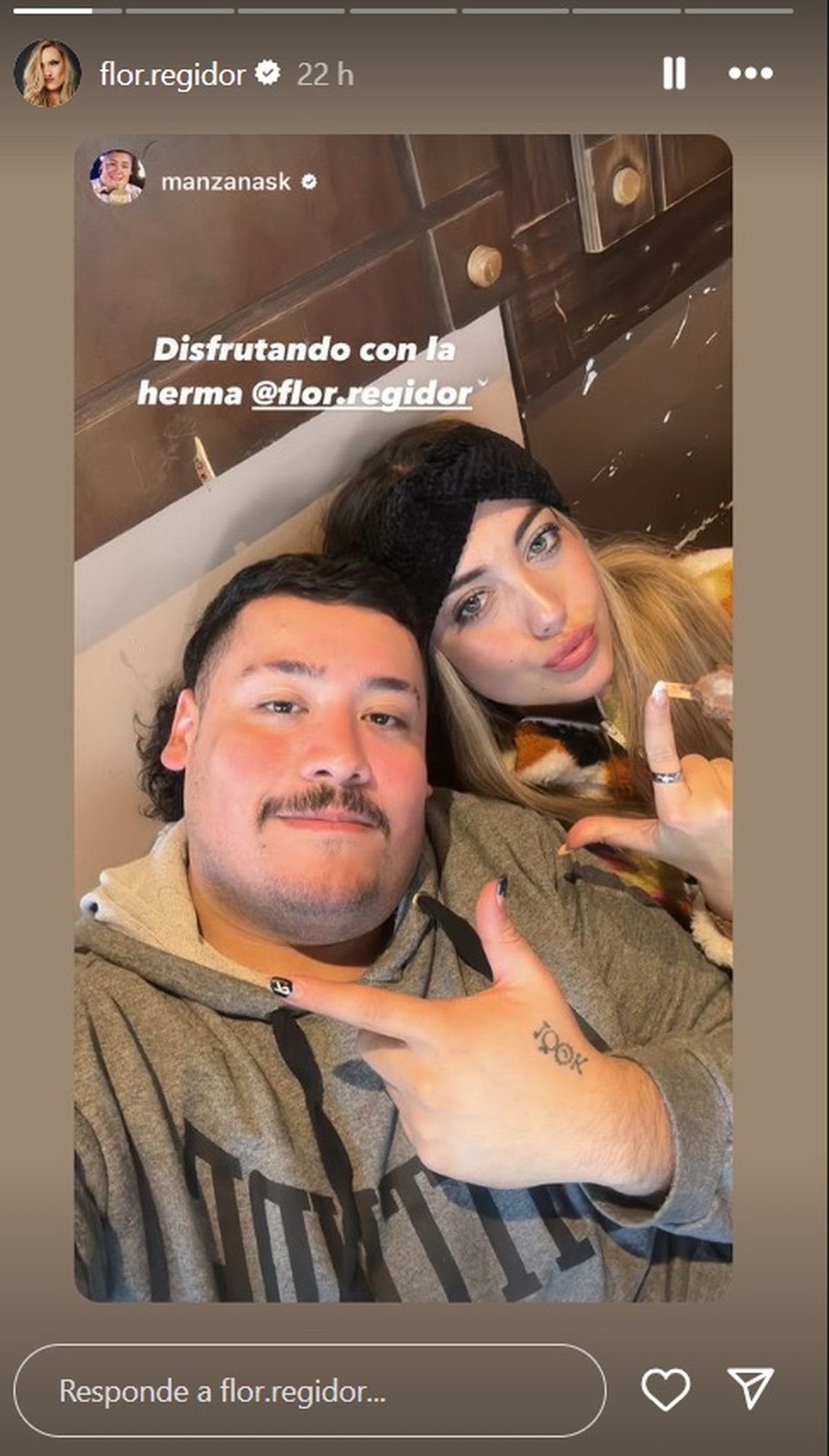 Manzana sufrió un doloroso accidente mientras realizaba una actividad ...