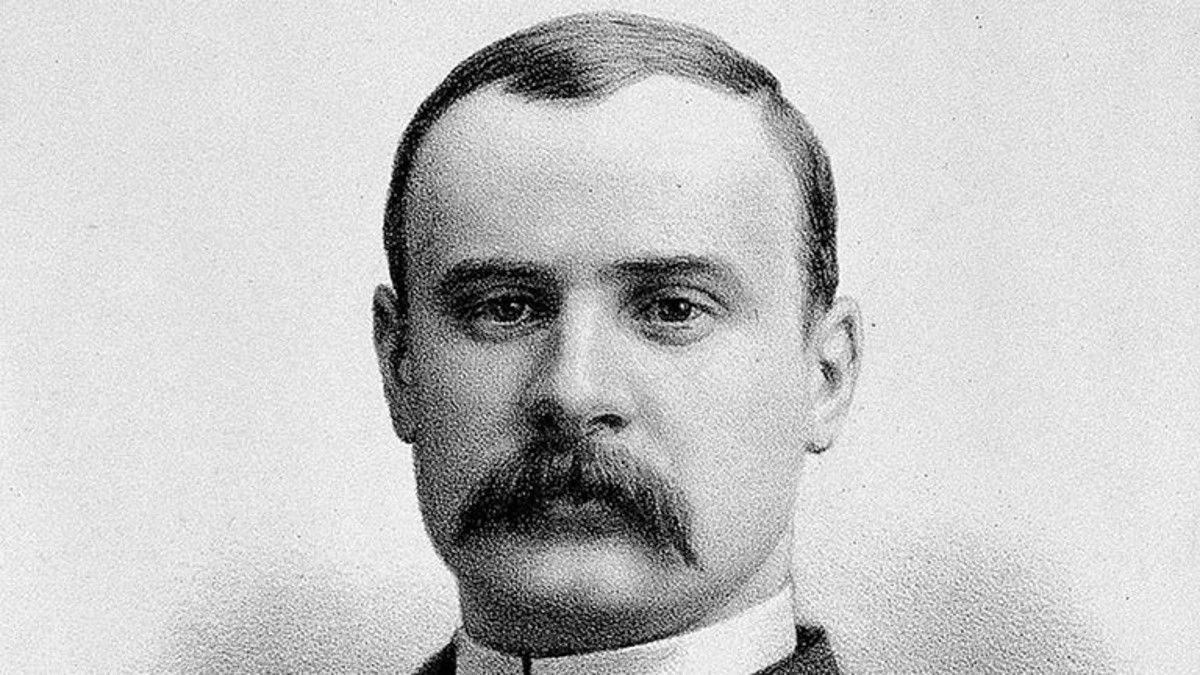 Lo apodaron el hombre elefante y vivió atormentado por su aspecto: la ...