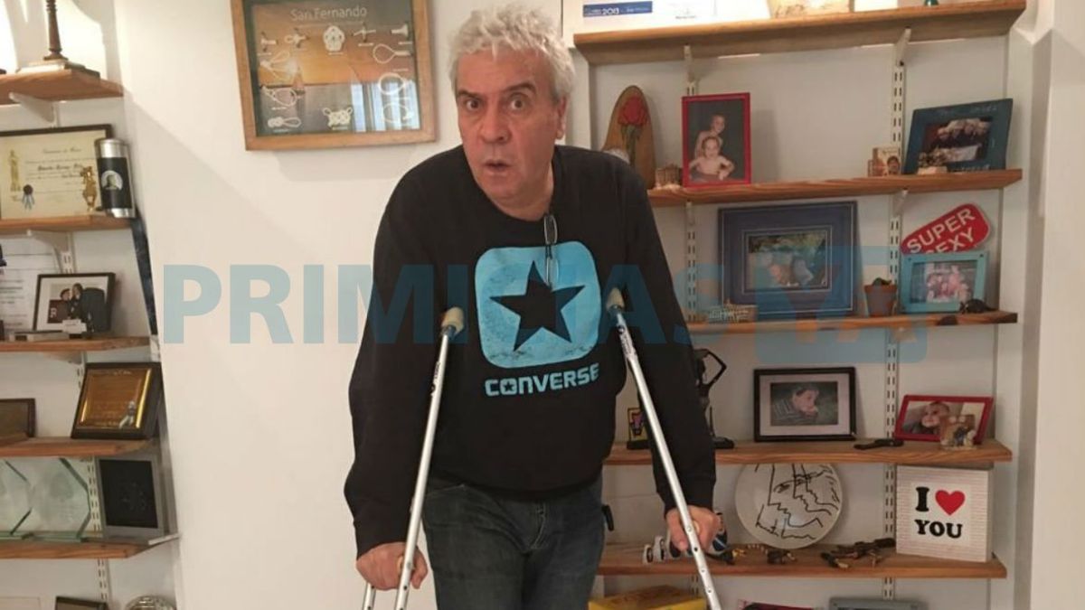 Coco Sily: Me caí de la moto y me fracturé el peroné