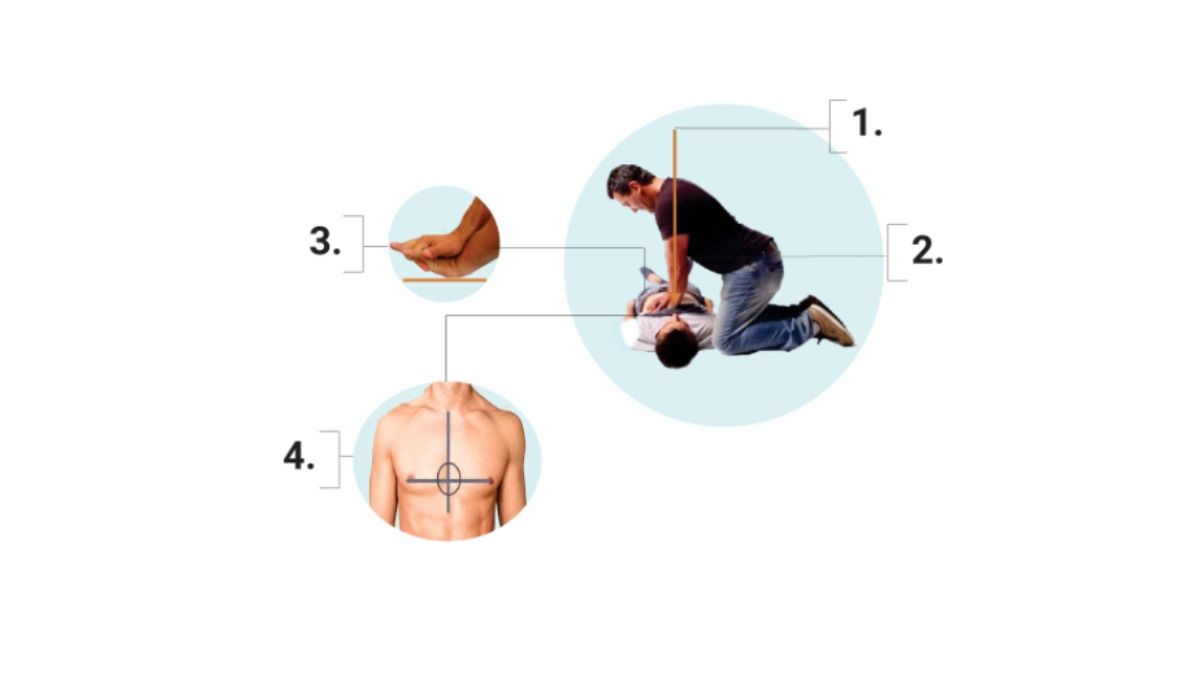 Reanimación cardiopulmonar: ¿qué es, para qué sirve y cómo se hace RCP?