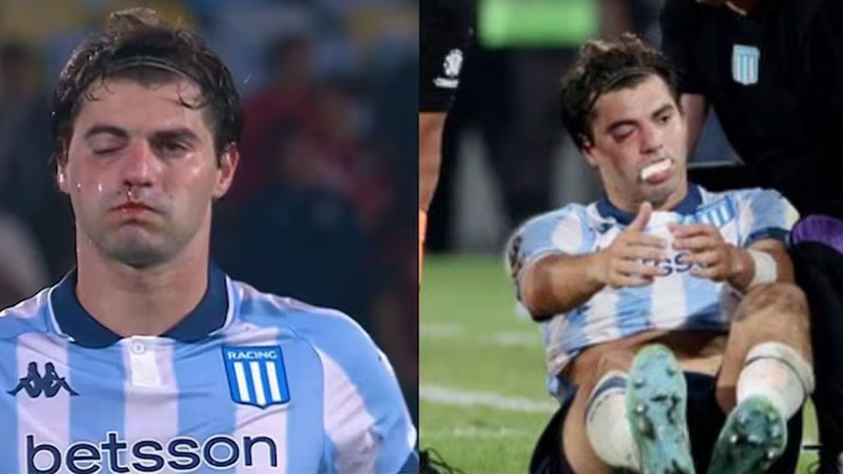 Alarma en Racing: Sosa sufrió una fractura por un codazo de Marcos Rojo ...