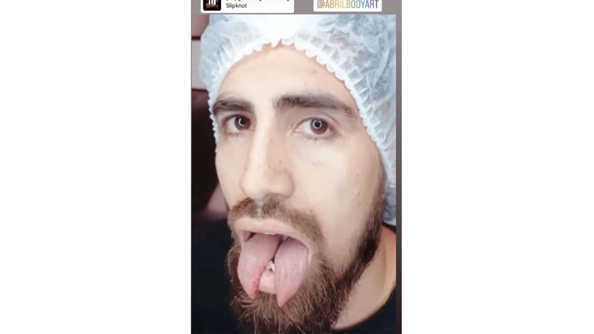 Futbolista se sometió a una imponente cirugía para tener una lengua bífida