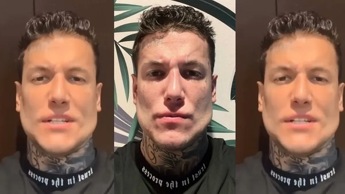 La nueva foto de Alex Caniggia tras operarse la mandíbula: Cada día estoy más facha