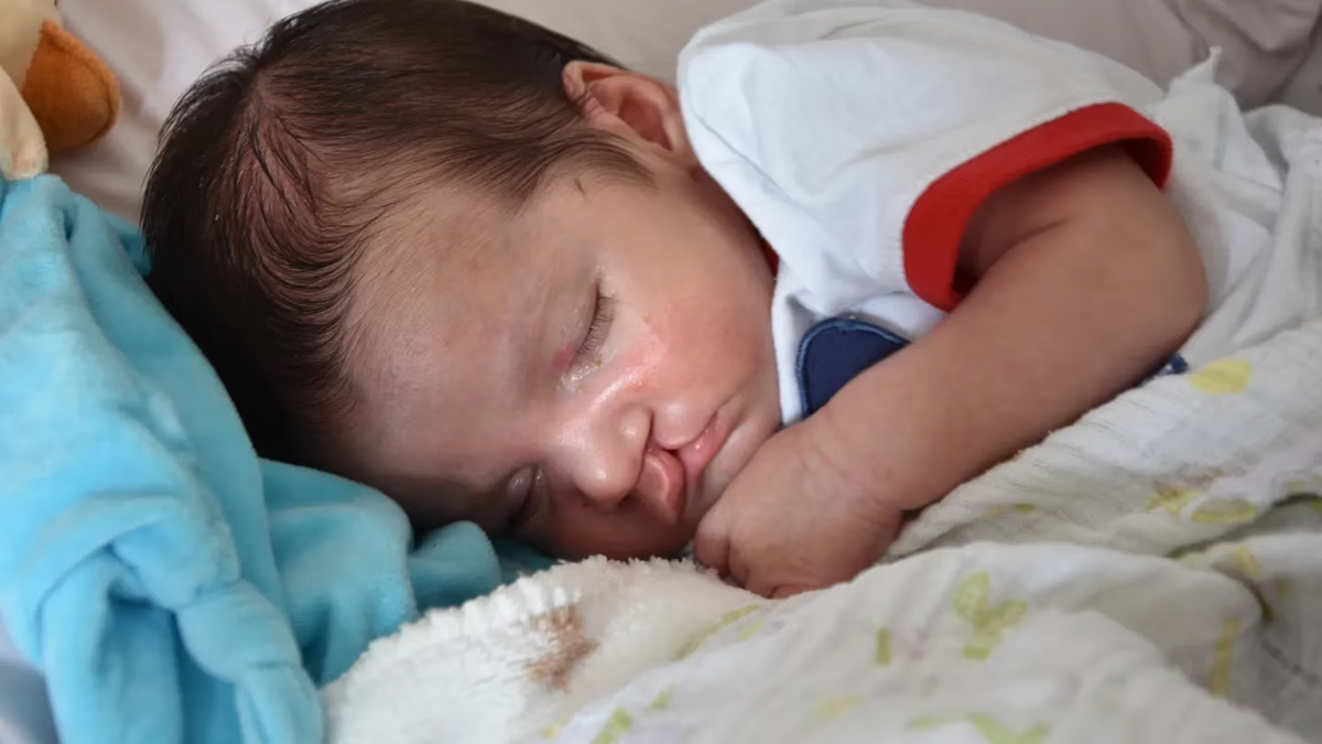 Descubren las causas de la formación del labio leporino