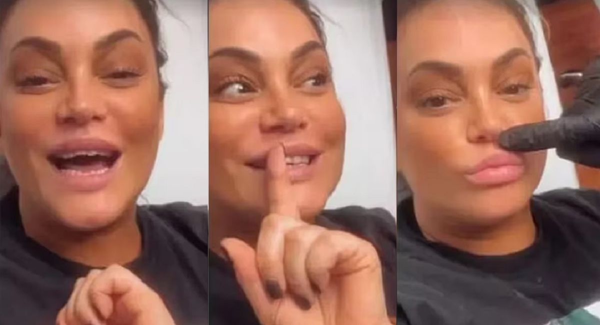 María Eugenia Ritó mostró el video del tratamiento estético que se hizo ...