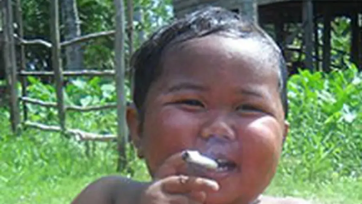 La increíble transformación del nene obeso y fumador de 2 años