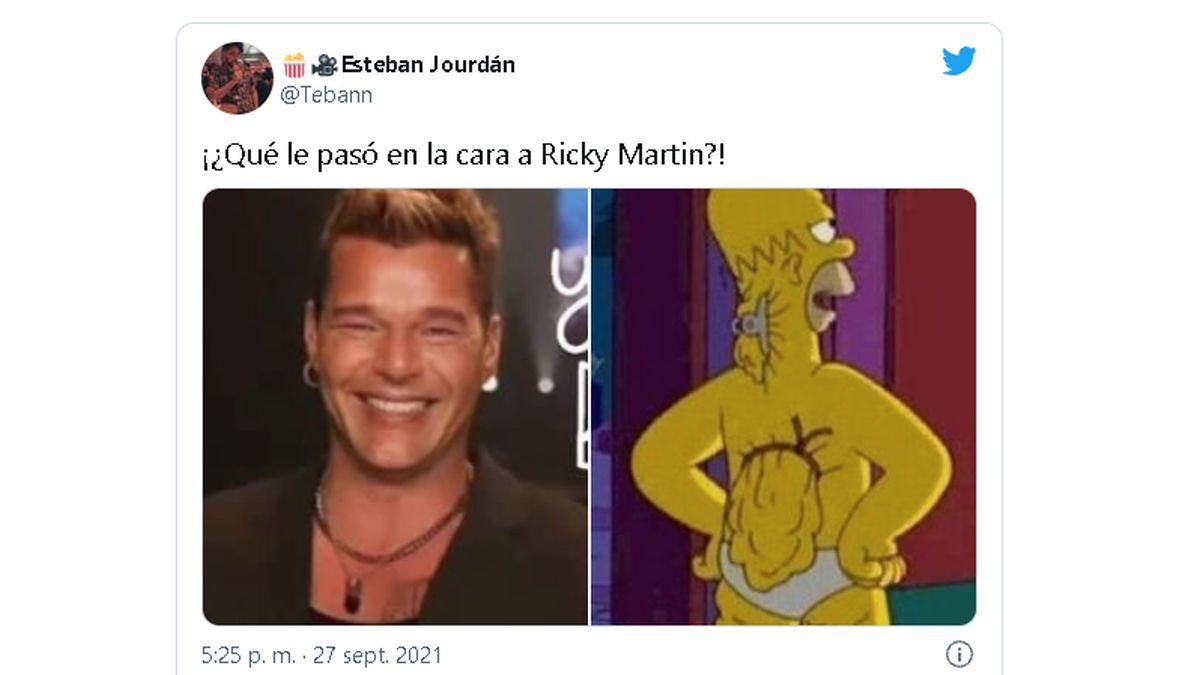 Viral: Ricky Martin se apareció con un drástico cambio en su rostro y ...