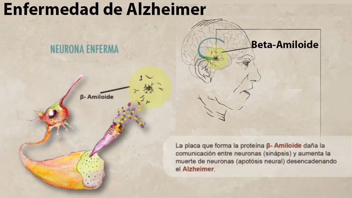 Avance en medicina: la FDA da un nuevo paso para aprobar el uso de un ...