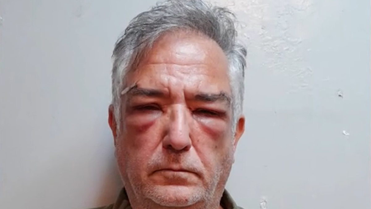 Caso ANDIS: Miguel Ángel Calvete se negó a declarar y seguirá detenido ...