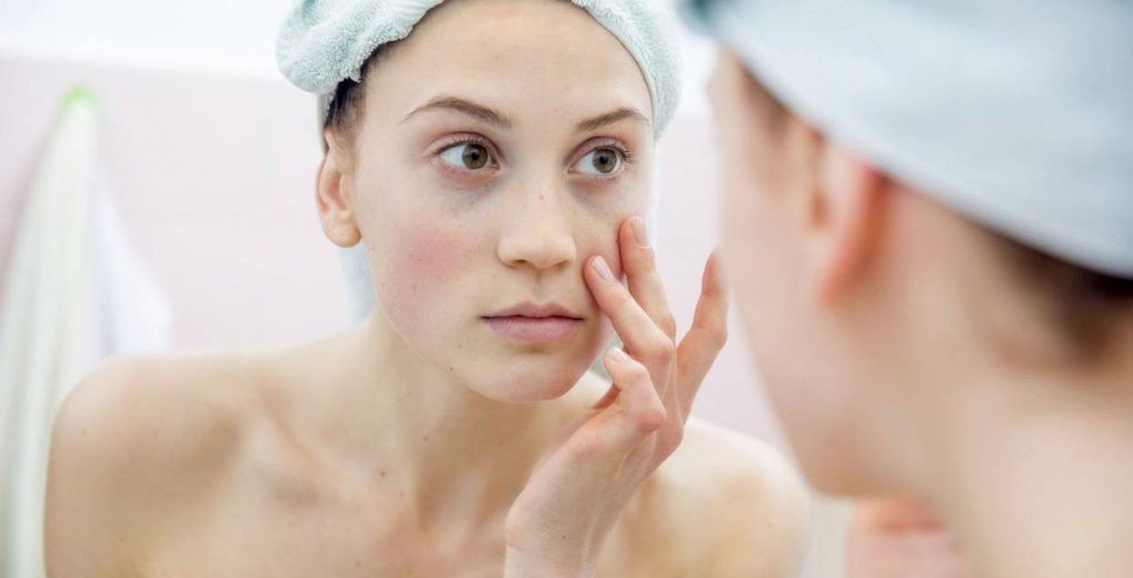 ¿Cómo quitar ojeras? Consejos útiles