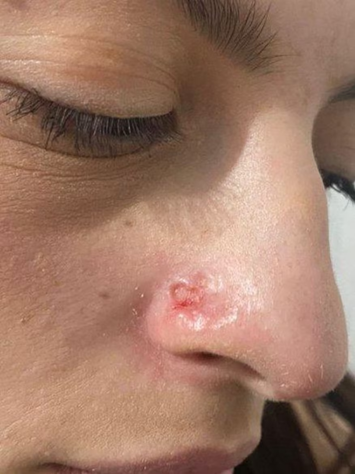 La sorprendente historia de la joven de 27 años que descubrió un cáncer mortal después de una ...