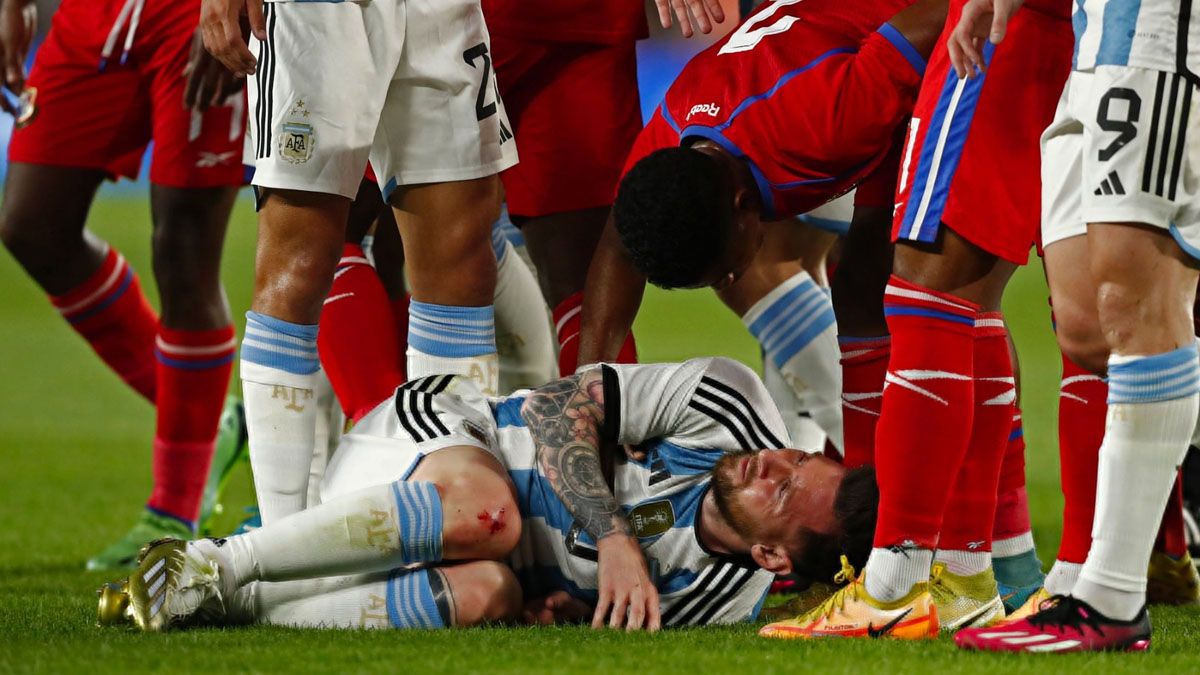 La impactante imagen de la rodilla de Lionel Messi tras un patadón en ...